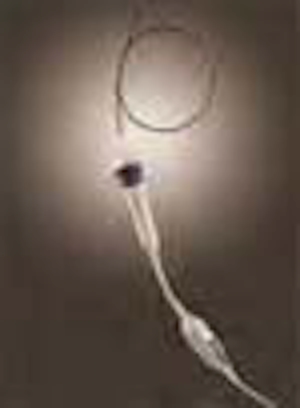 FDA OKs Acuson's AcuNav diagnostic ultrasound catheter | AuntMinnie