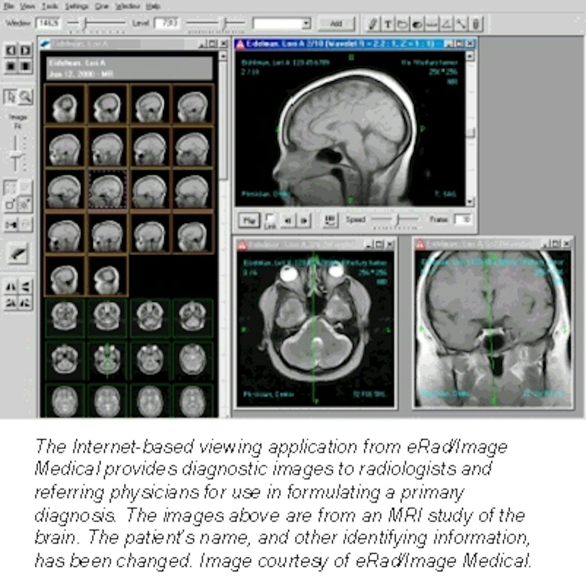 eRad/Image Medical targets Web-based PACS | AuntMinnie