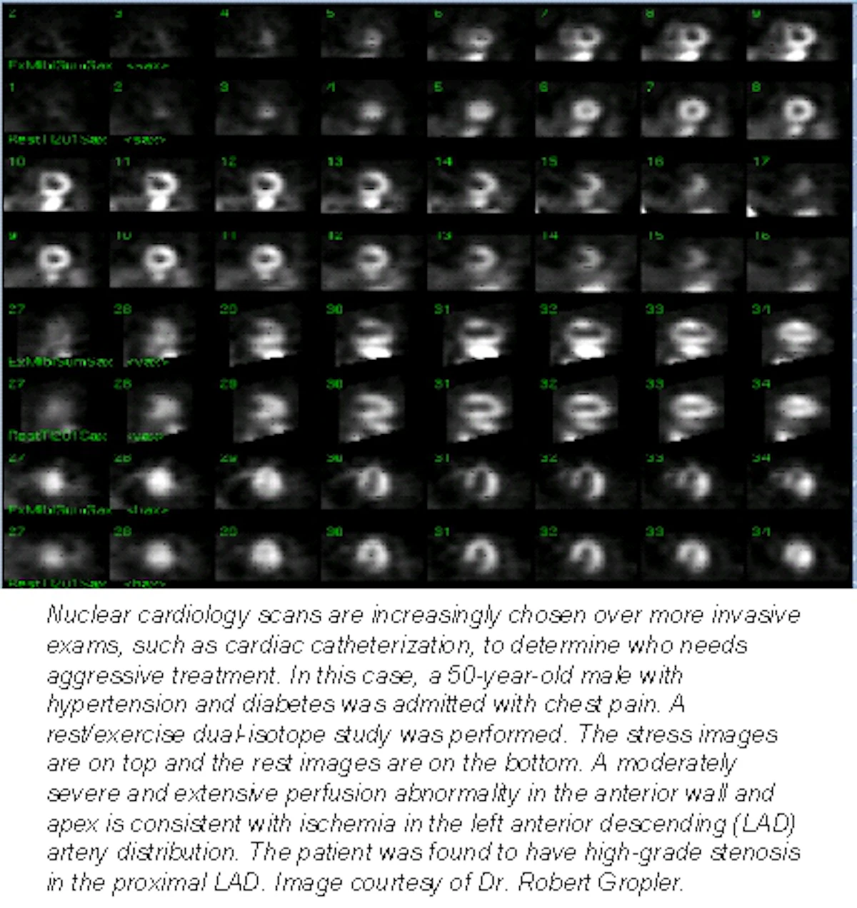 Turf Wars in Radiology, Part III: All is not lost in nuclear cardiology ...
