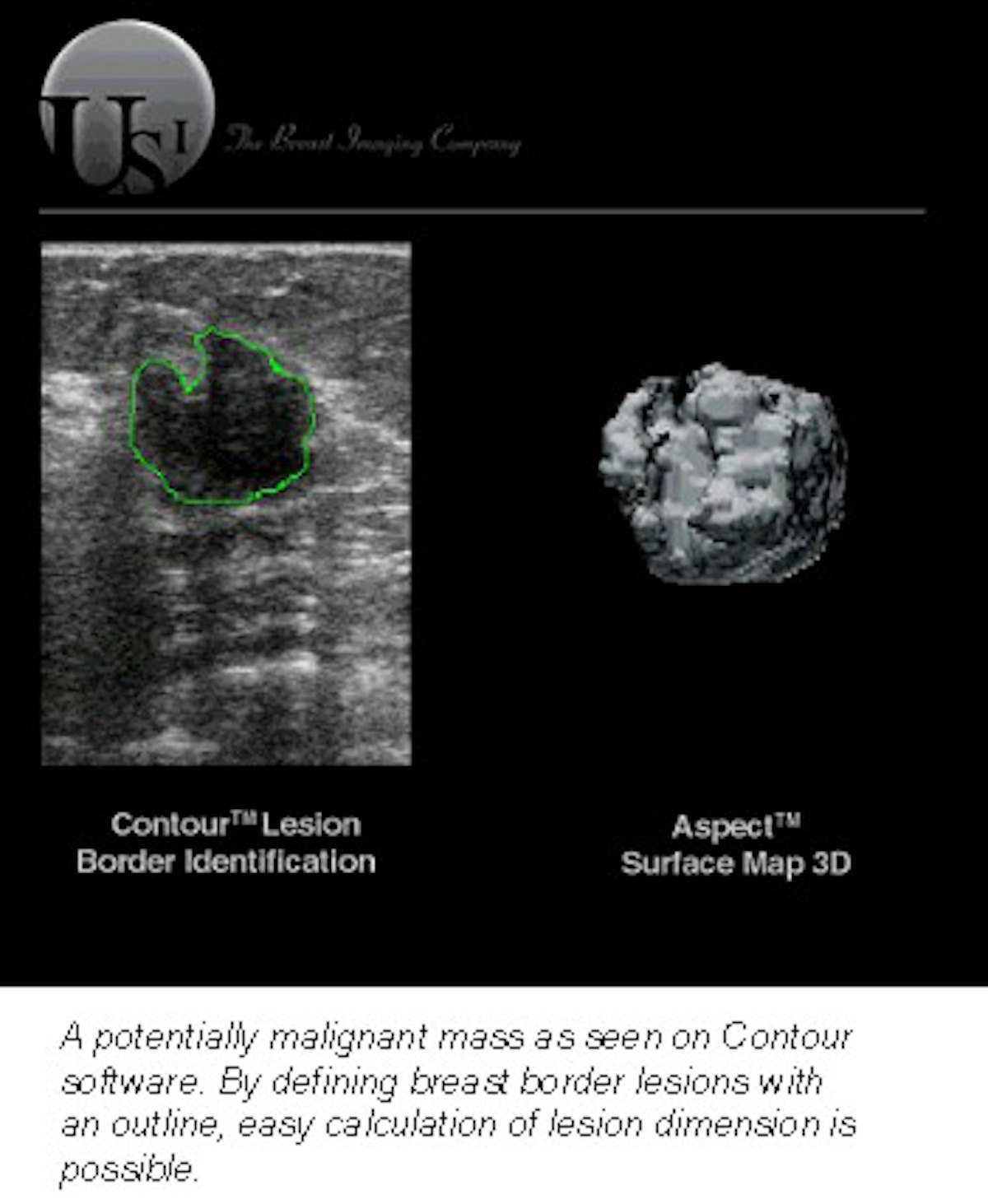 U-Systems develops CAD tools for breast ultrasound | AuntMinnie
