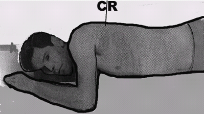 Positioning techniques for quality esophagrams | AuntMinnie