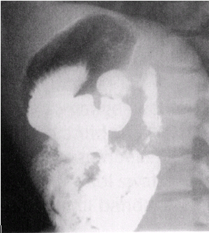 Patient positioning tips for a premium UGI series | AuntMinnie