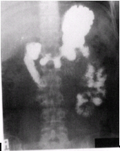 Patient positioning tips for a premium UGI series | AuntMinnie