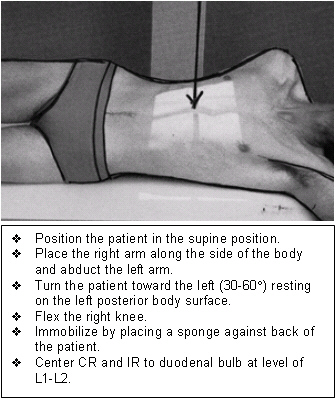 Patient positioning tips for a premium UGI series | AuntMinnie