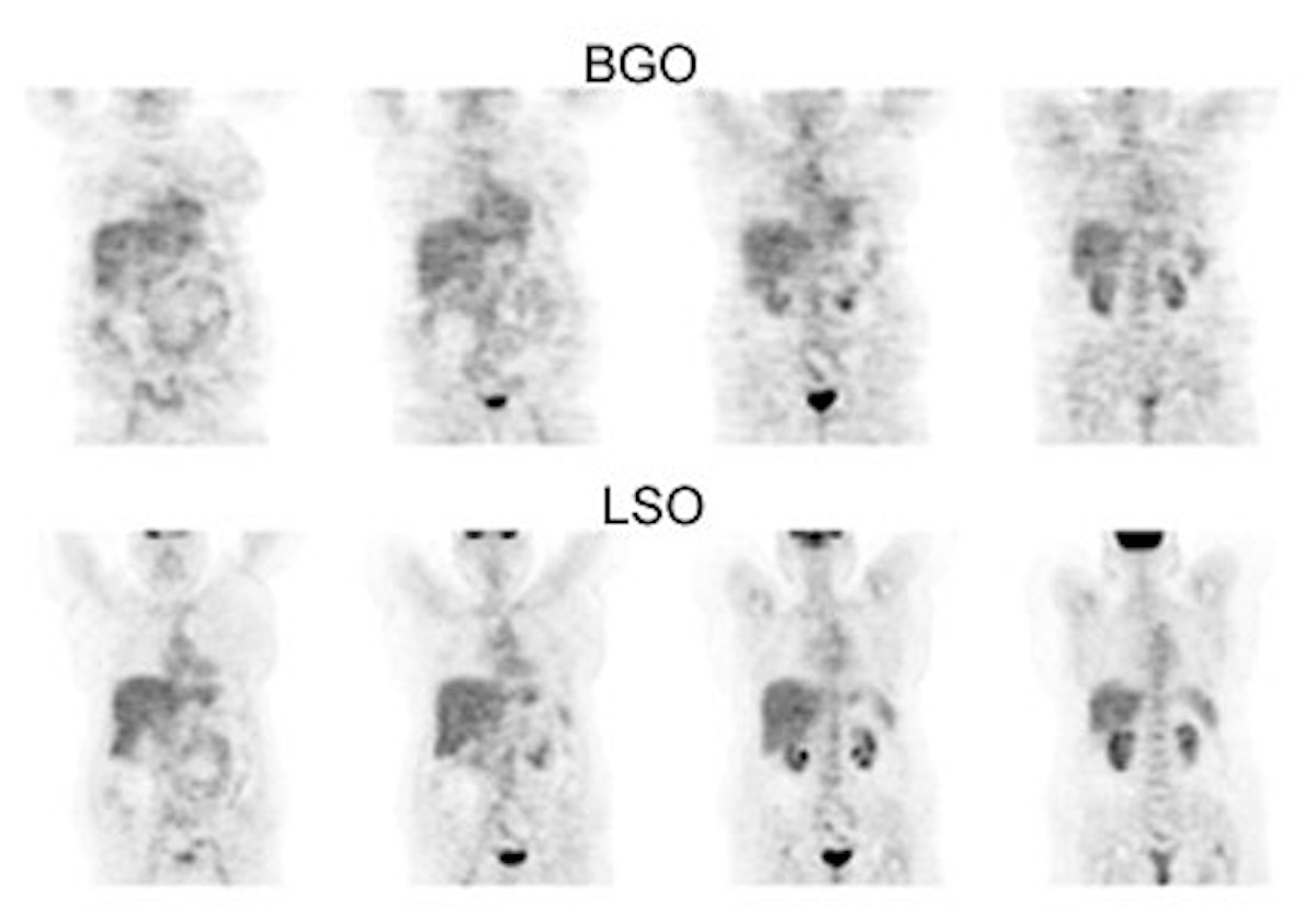pet scan spatial resolution
