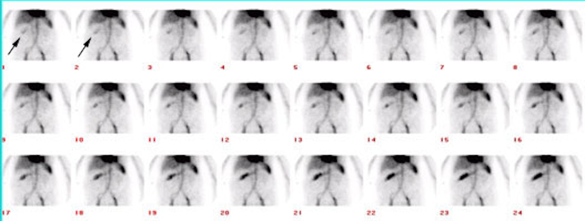 Gastrointestinal > RBC imaging | AuntMinnie