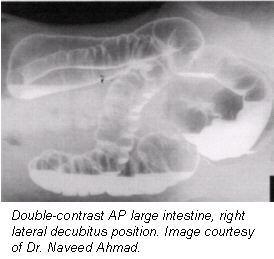 Patient positioning techniques for a lower gastrointestinal series ...
