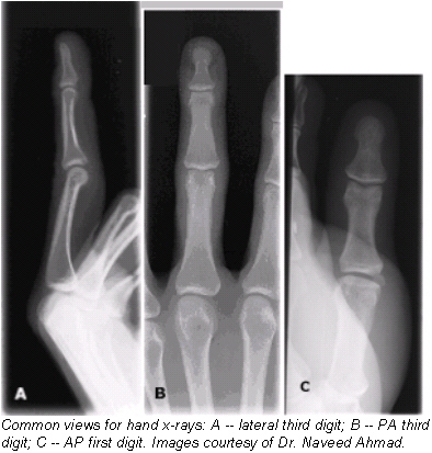 Digit imaging requires diligent positioning | AuntMinnie