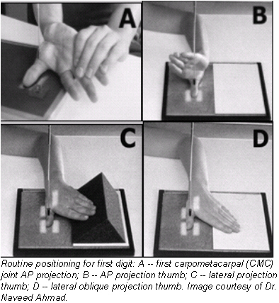 Digit imaging requires diligent positioning | AuntMinnie