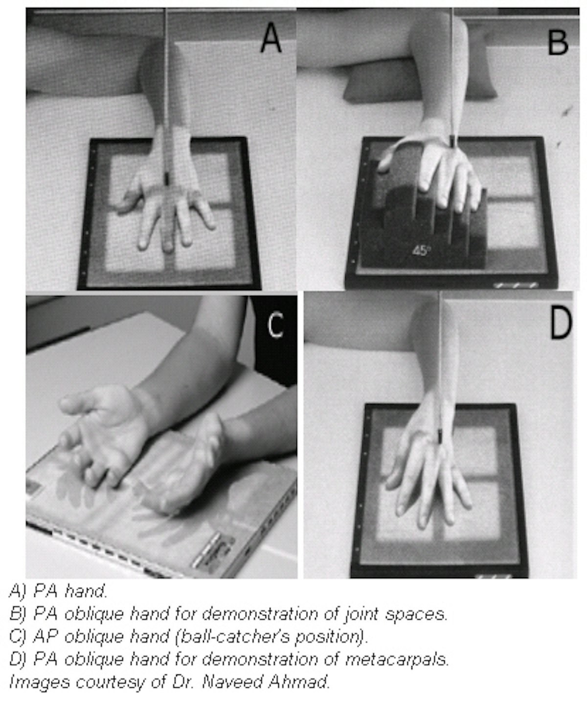 hand x ray positioning