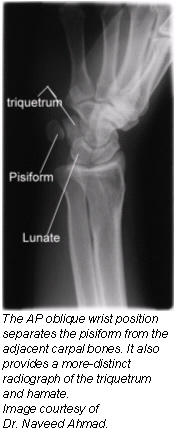 The twists and turns of hand and wrist x-ray positioning | AuntMinnie