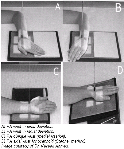 The twists and turns of hand and wrist x-ray positioning | AuntMinnie