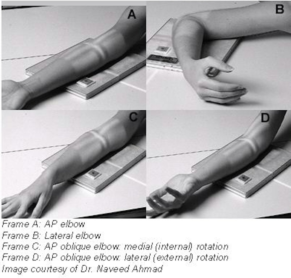 x ray arm position
