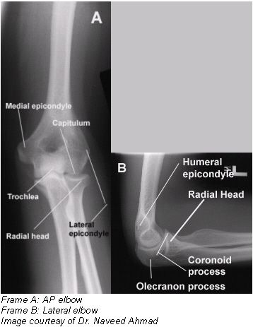 The bends and flexures of forearm and elbow x-ray positioning | AuntMinnie