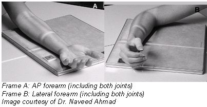 The bends and flexures of forearm and elbow x-ray positioning | AuntMinnie