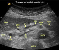 Ultrasound of the pancreas: what normal looks like | AuntMinnie