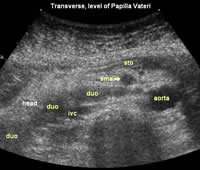 Ultrasound of the pancreas: what normal looks like | AuntMinnie
