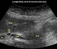 Ultrasound of the pancreas: what normal looks like | AuntMinnie