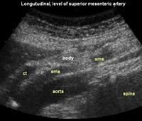 Ultrasound of the pancreas: what normal looks like | AuntMinnie