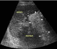 Ultrasound of the pancreas: what normal looks like | AuntMinnie