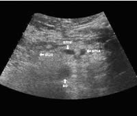 Ultrasound of the pancreas: what normal looks like | AuntMinnie
