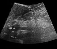 Ultrasound of the pancreas: what normal looks like | AuntMinnie