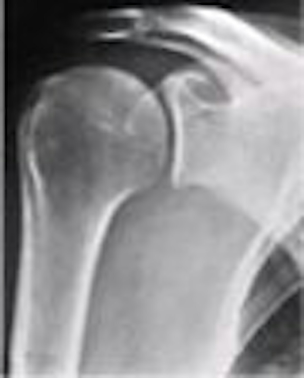 Getting the most from shoulder positioning | AuntMinnie