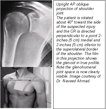 Getting the most from shoulder positioning | AuntMinnie