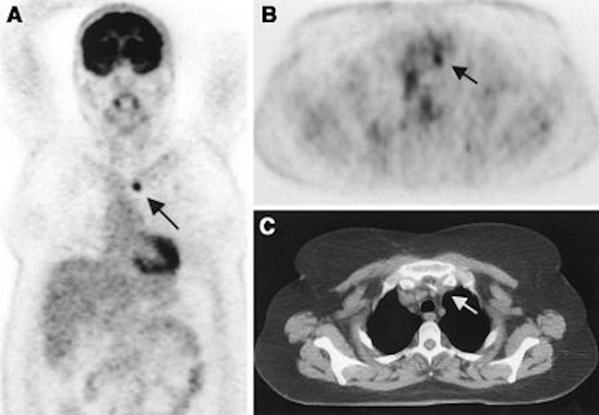 Studies illustrate benefits of FDG-PET, pre-planning in radiotherapy ...