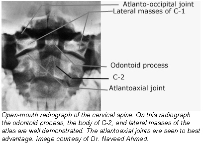 Radiographic positioning techniques for the cervical spine | AuntMinnie