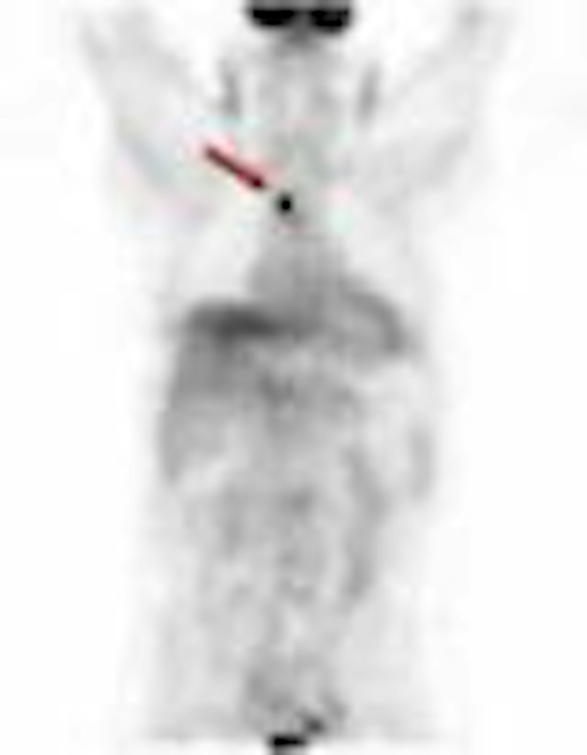 LSO PET/CT study wins Image of the Year | AuntMinnie