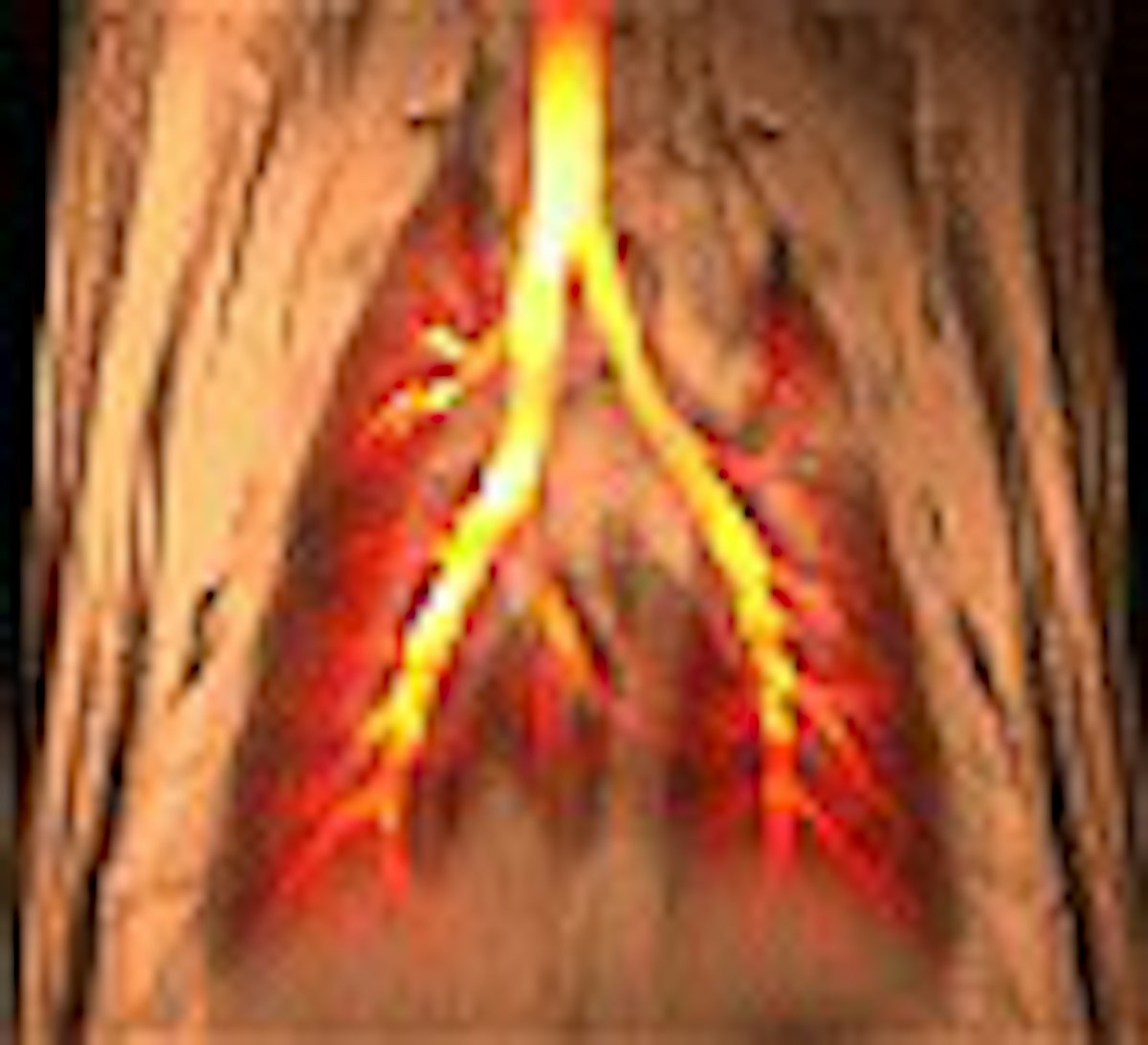 Dynamic MRI of helium inhalation reveals asthmatic pulmonary function ...