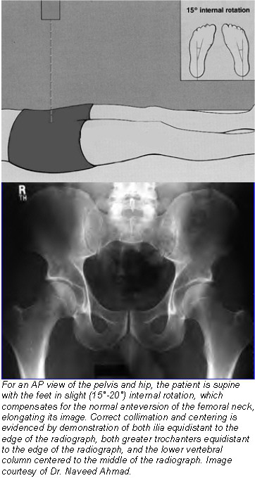 Proper positioning for the pelvis and proximal femur | AuntMinnie
