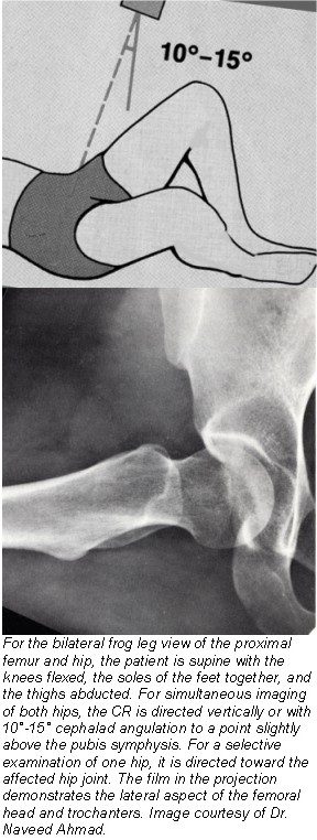 Proper positioning for the pelvis and proximal femur | AuntMinnie