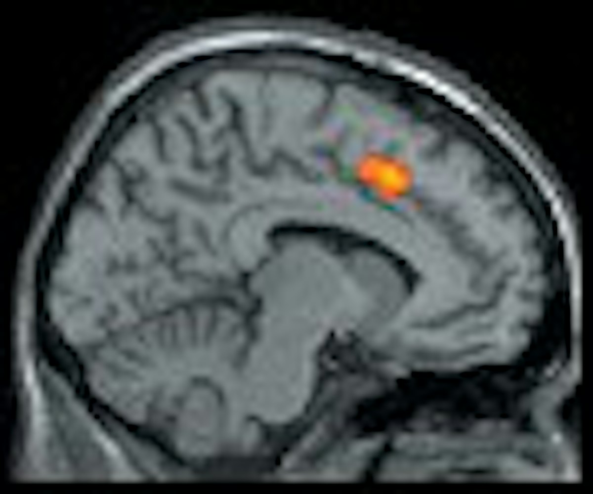 Same parts of brain say "ouch" when hurt physically or emotionally ...