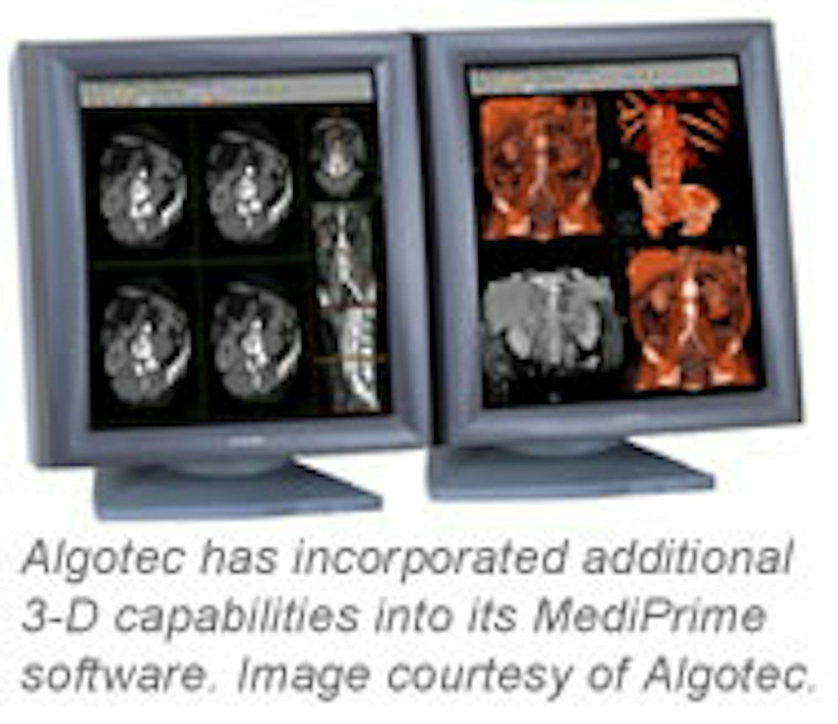 Algotec | AuntMinnie