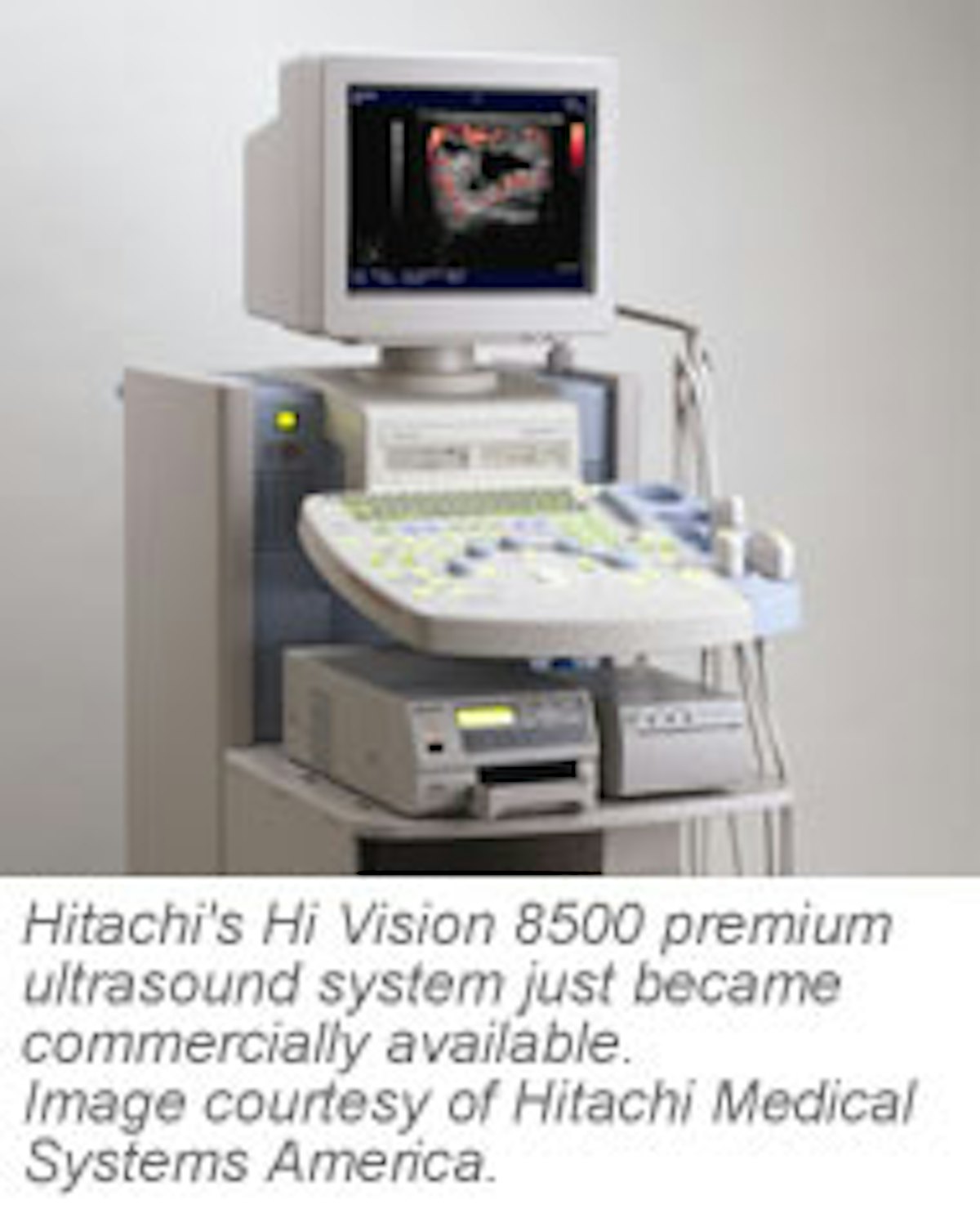 Hitachi Medical Systems America | AuntMinnie
