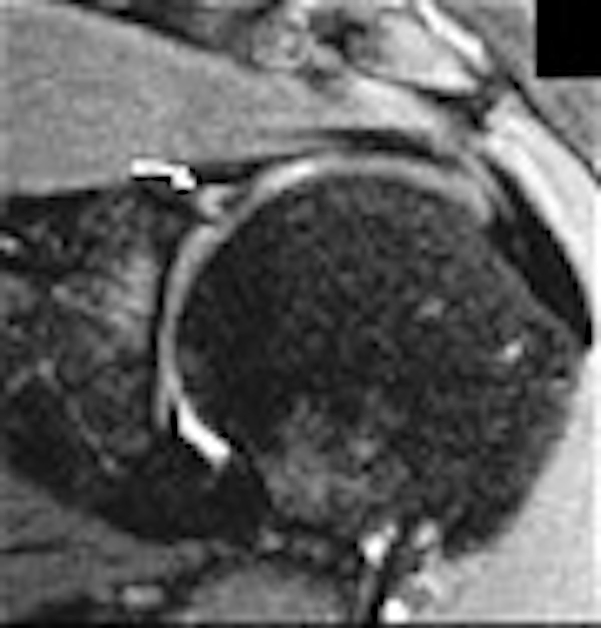 Low-field MR turns in varying results for MSK abnormalities, trauma ...