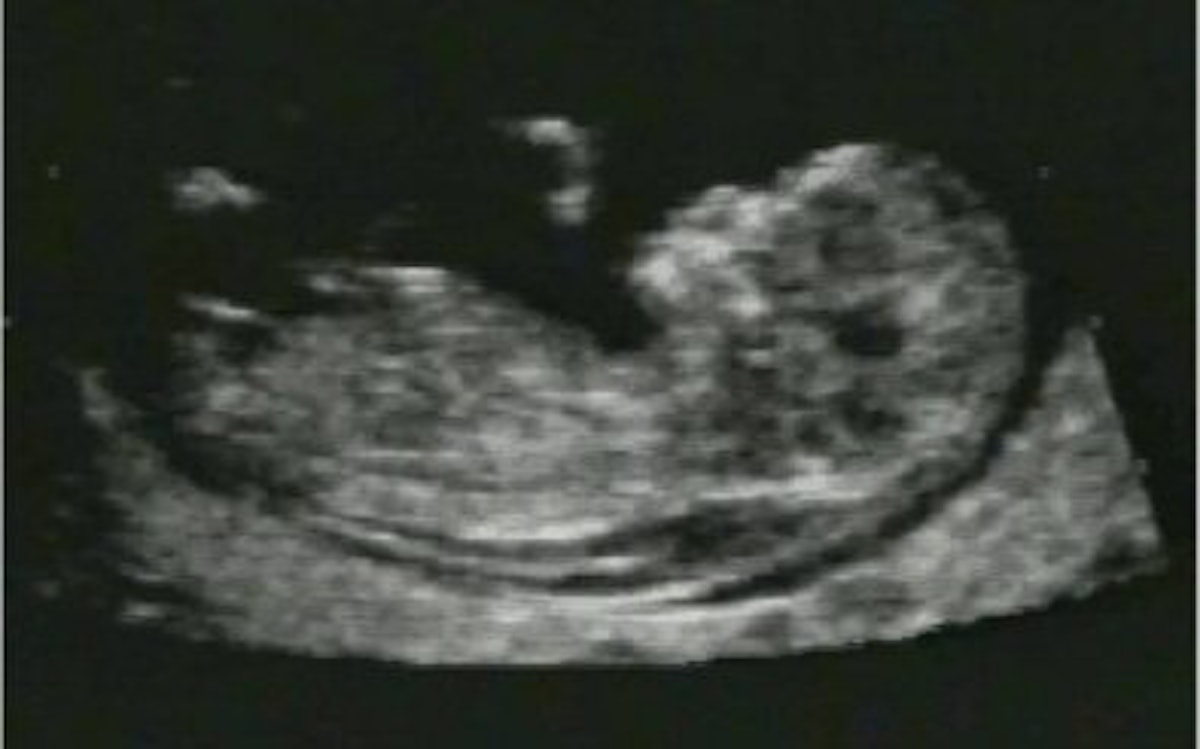 Biochem enters ultrasound domain in fetal screening | AuntMinnie