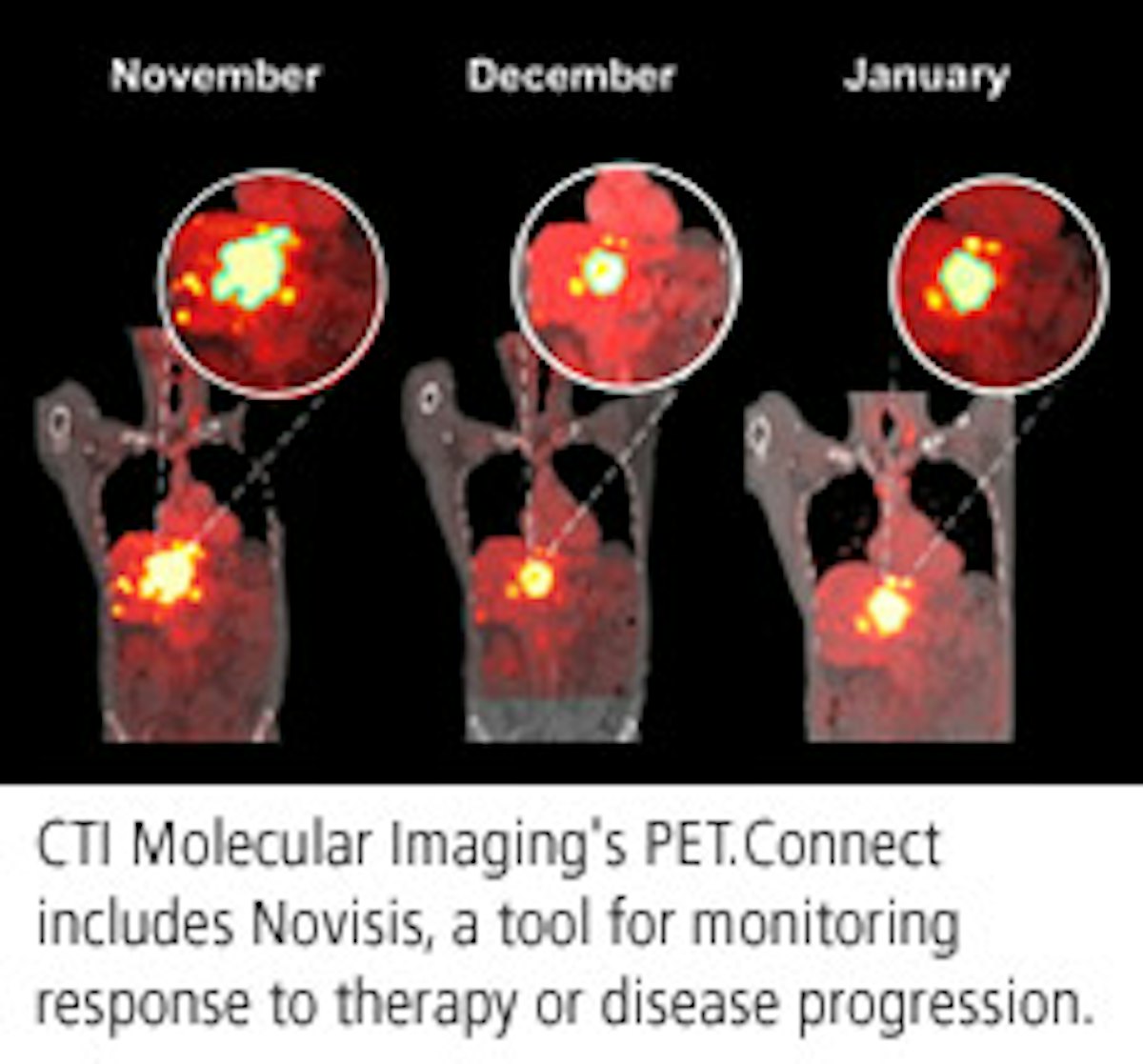 CTI Molecular Imaging | AuntMinnie