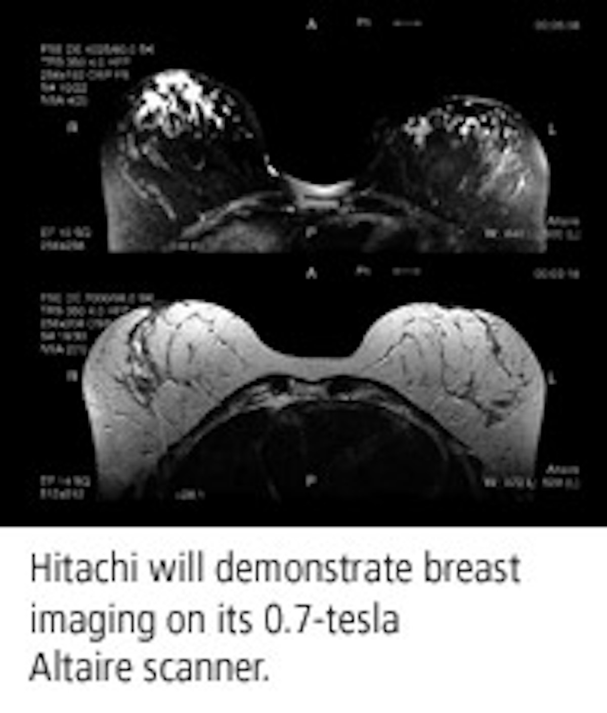 Hitachi Medical Systems America | AuntMinnie