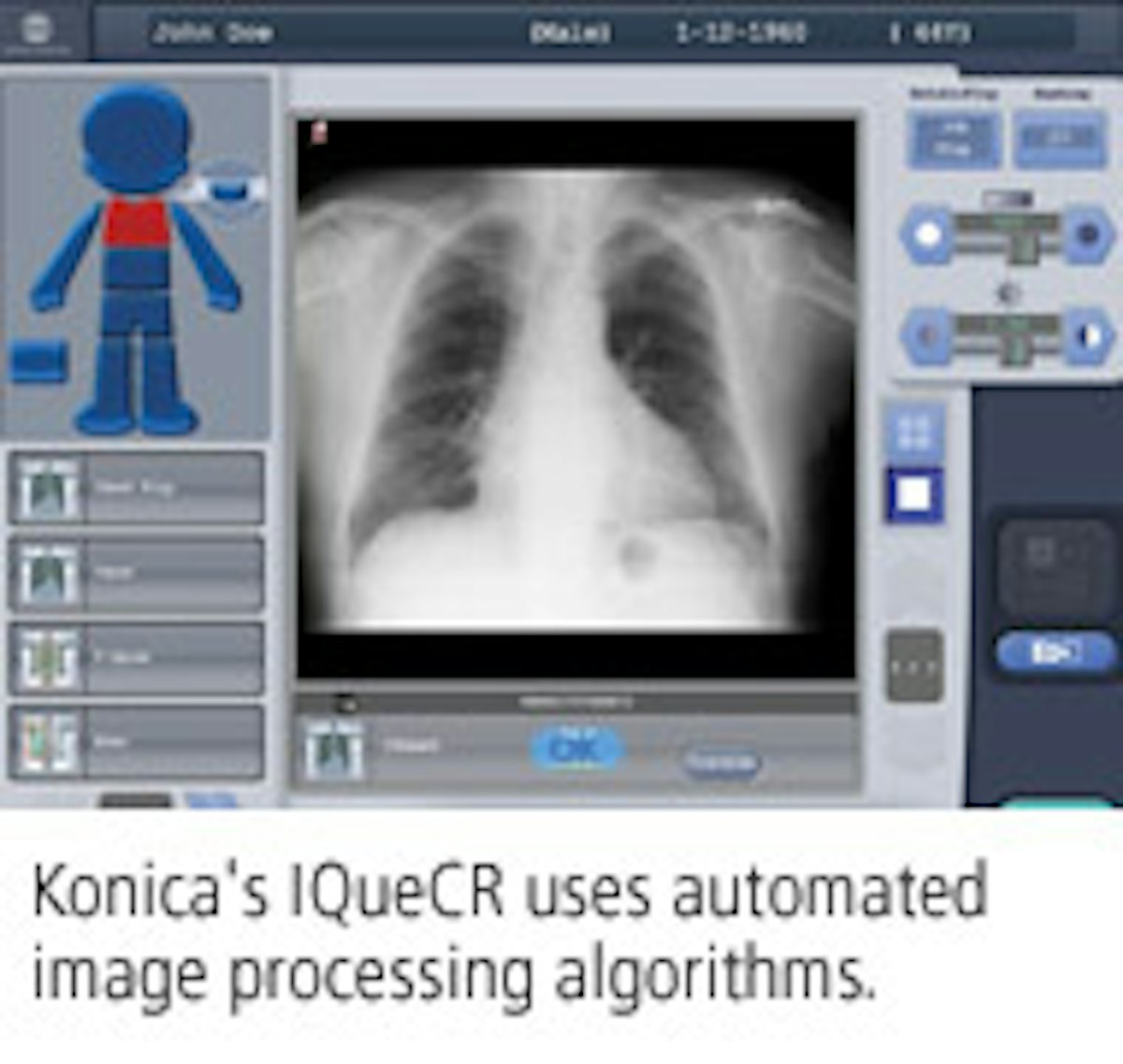 Konica Minolta Medical Imaging | AuntMinnie