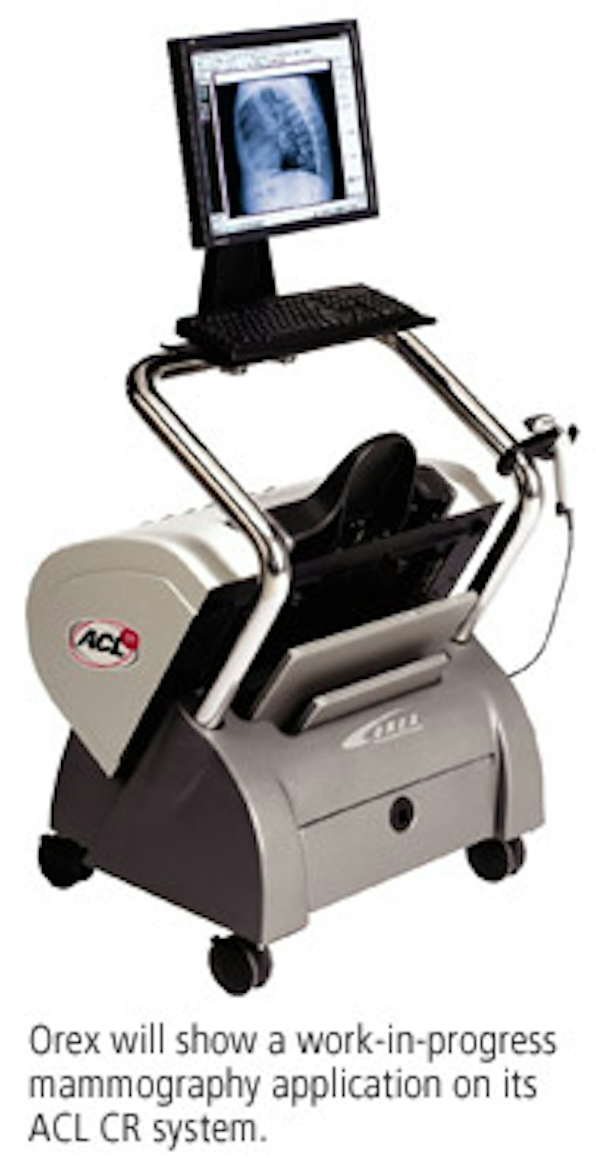 Orex Computed Radiography | AuntMinnie