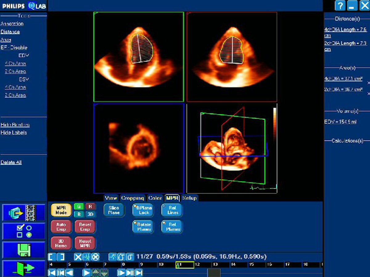 Cardiac PACS pace quickens | AuntMinnie