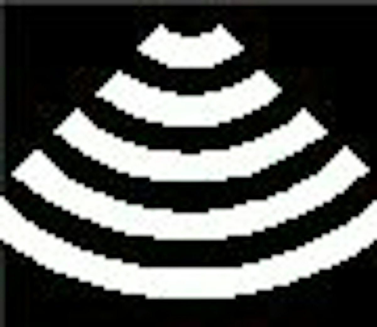 US may assist in diagnosing fatty atrophy in rotator cuff muscles ...