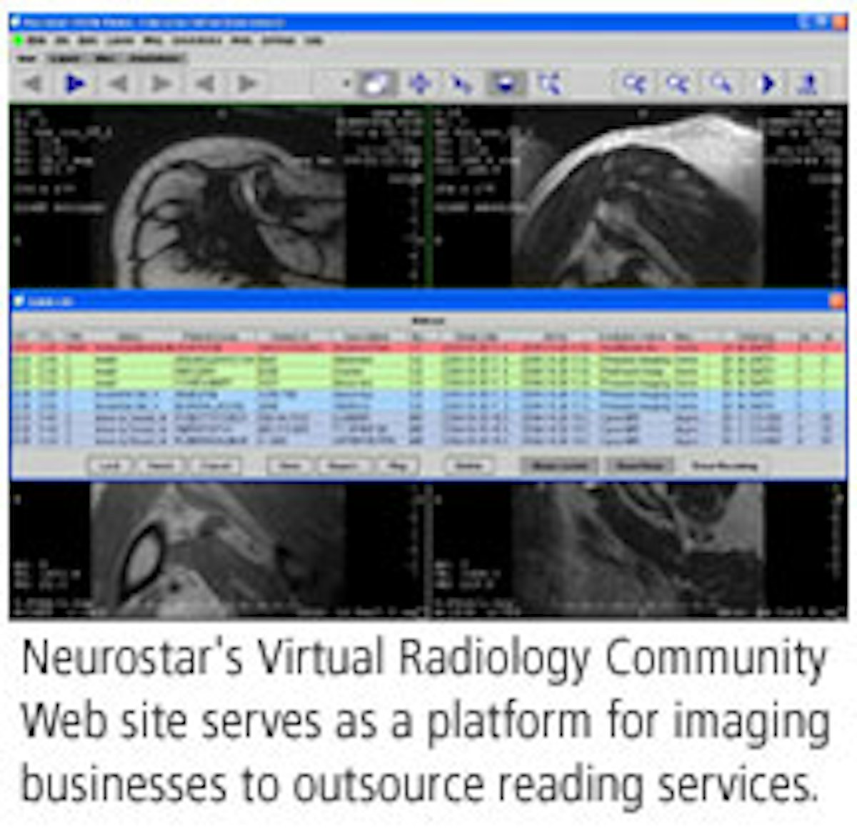 Neurostar Solutions | AuntMinnie