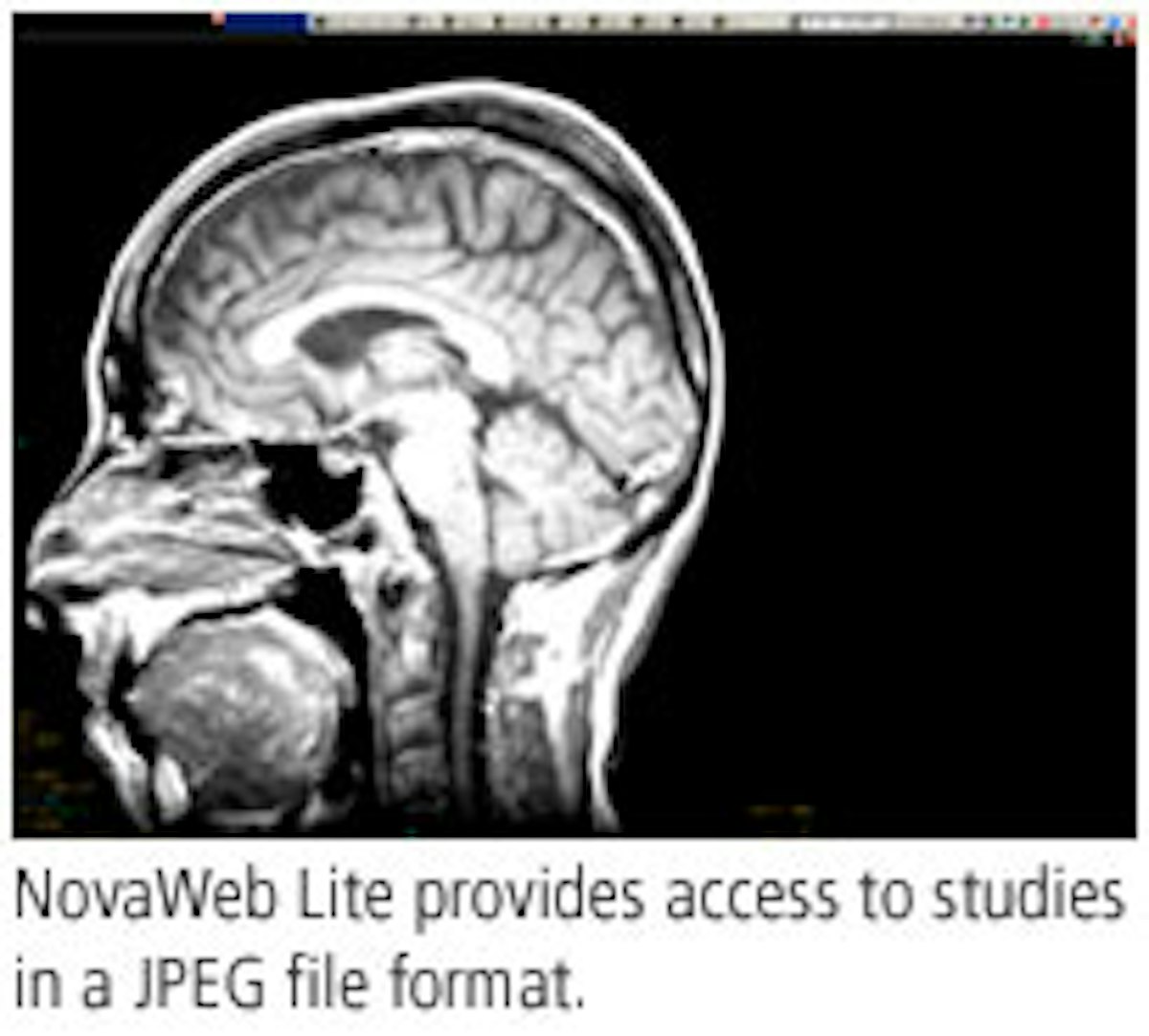 NovaRad | AuntMinnie