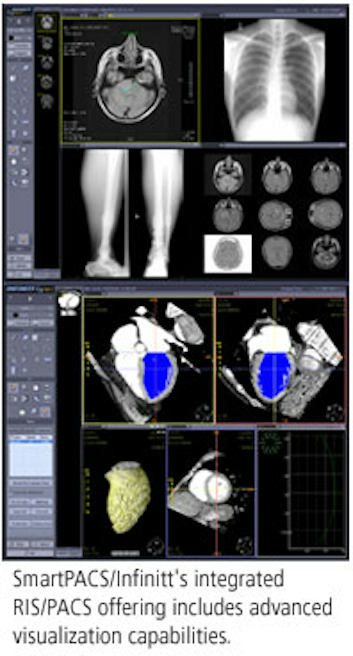 SmartPACS/Infinitt | AuntMinnie