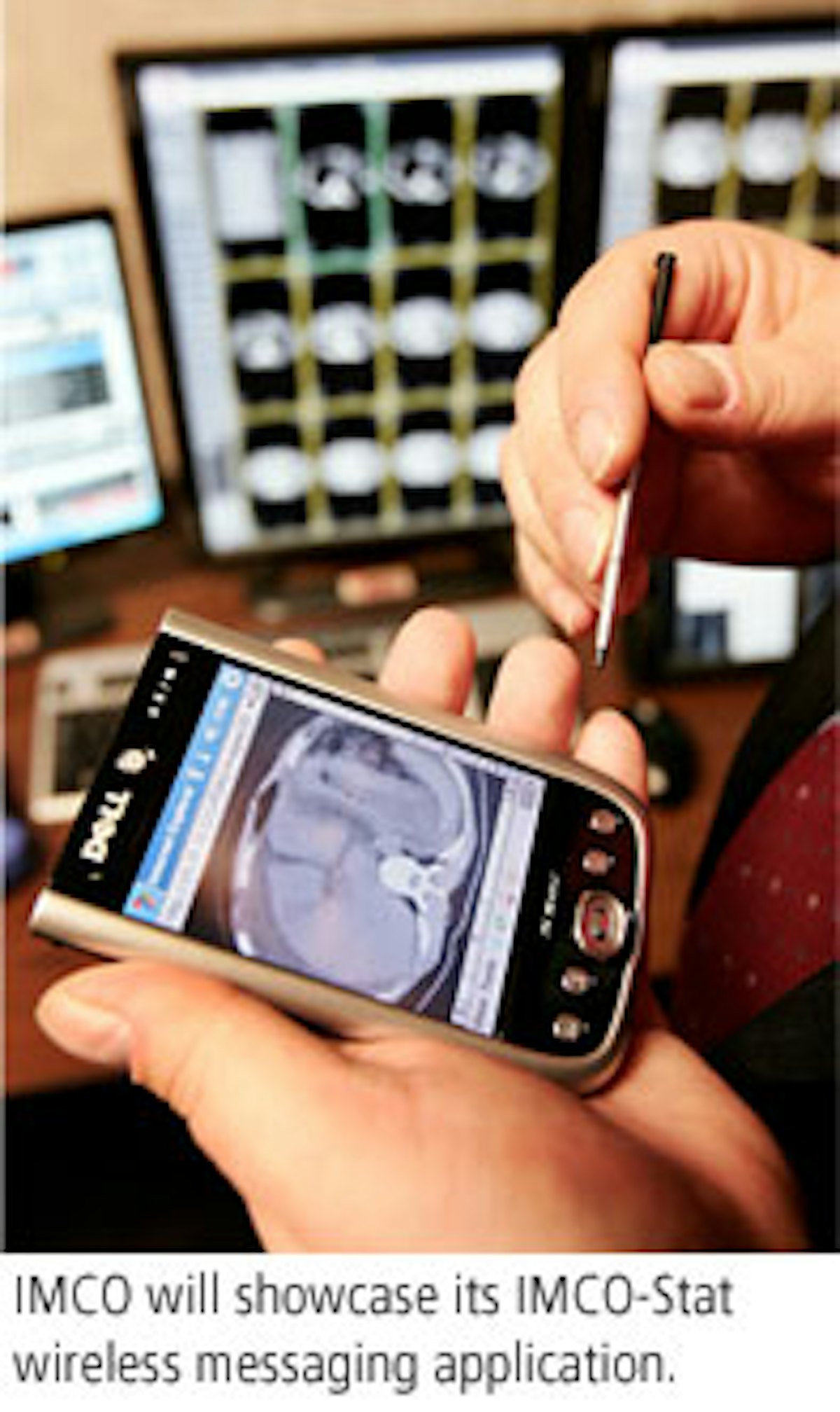 IMCO Technologies | AuntMinnie