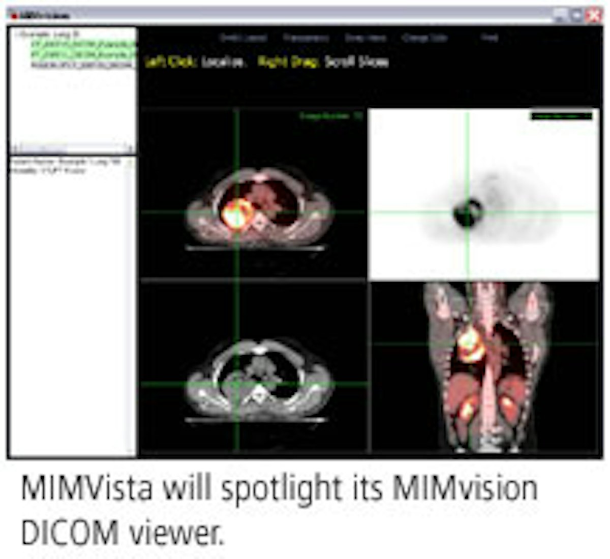 MIMVista | AuntMinnie